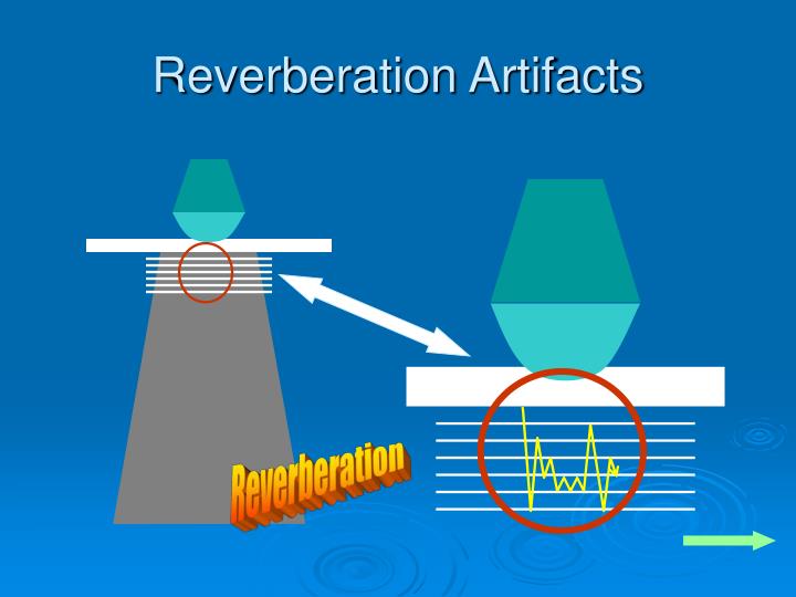 PPT - Ultrasound Physics PowerPoint Presentation - ID:1244413