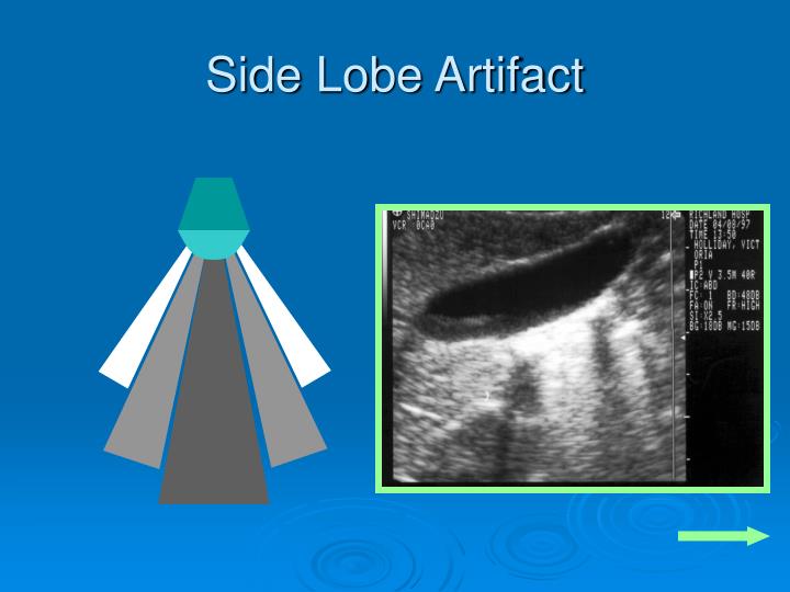 PPT - Ultrasound Physics PowerPoint Presentation - ID:1244413