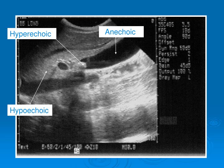 PPT - Ultrasound Physics PowerPoint Presentation - ID:1244413