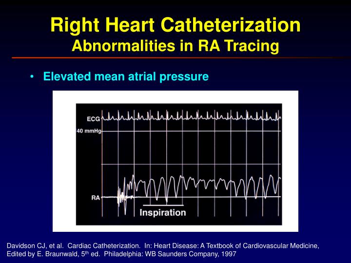 PPT - Hemodynamic Principles The Fundamentals PowerPoint Presentation ...