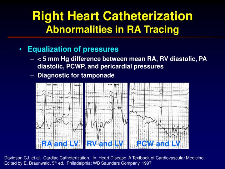 PPT - Hemodynamic Principles The Fundamentals PowerPoint Presentation ...