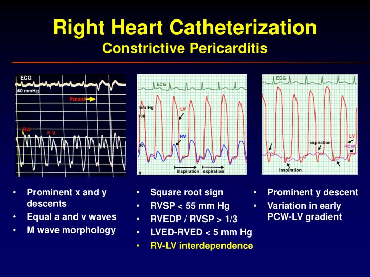 PPT - Hemodynamic Principles The Fundamentals PowerPoint Presentation ...
