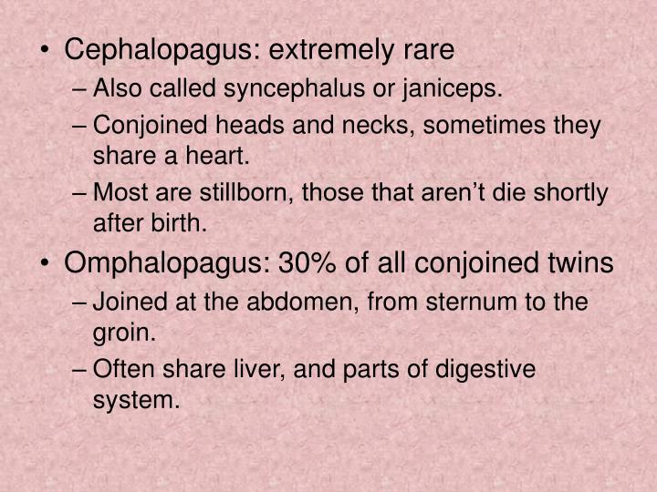 PPT - Conjoined Twins PowerPoint Presentation - ID:1245222