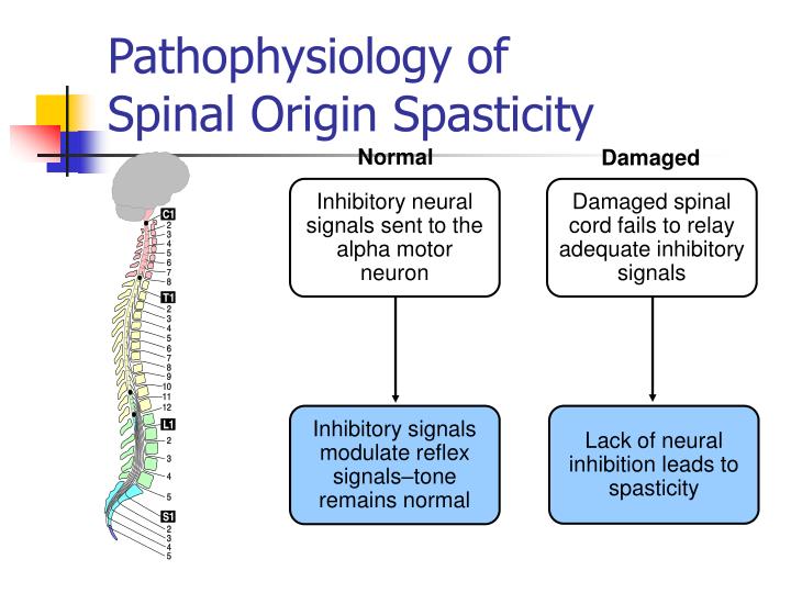 PPT - Intrathecal Baclofen for Spasticity PowerPoint Presentation - ID ...