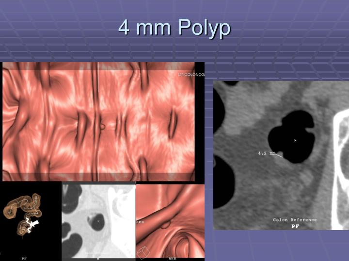 PPT - GASTROINTESTINAL RADIOLOGY PowerPoint Presentation - ID:1246647