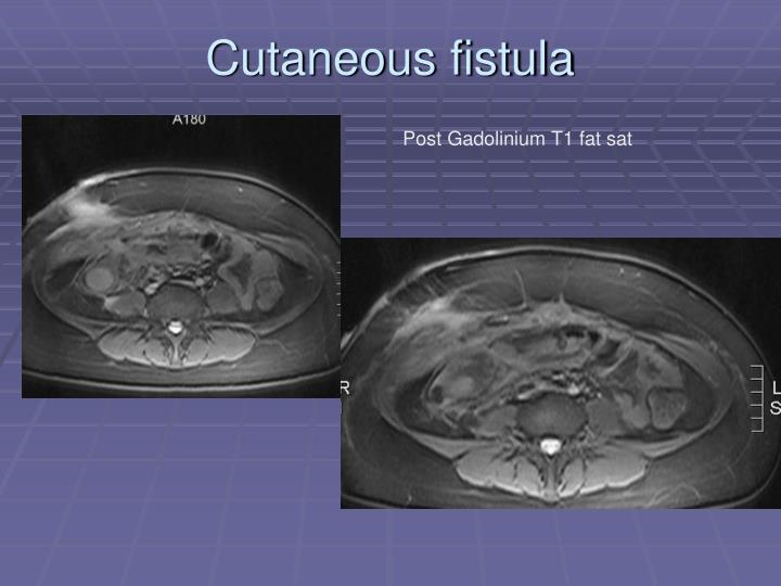 PPT - GASTROINTESTINAL RADIOLOGY PowerPoint Presentation - ID:1246647