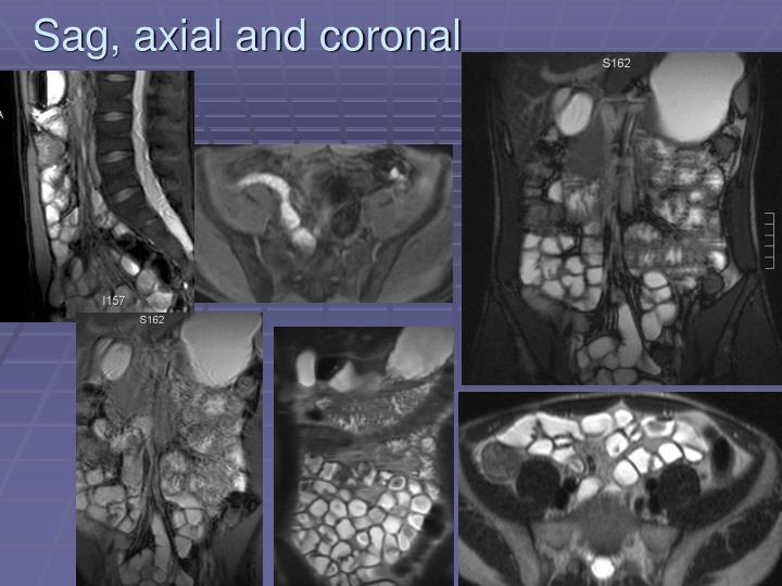 PPT - GASTROINTESTINAL RADIOLOGY PowerPoint Presentation - ID:1246647