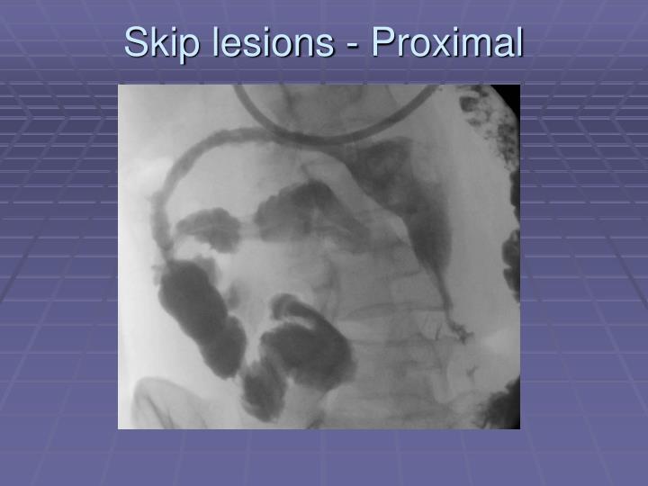 PPT - GASTROINTESTINAL RADIOLOGY PowerPoint Presentation - ID:1246647