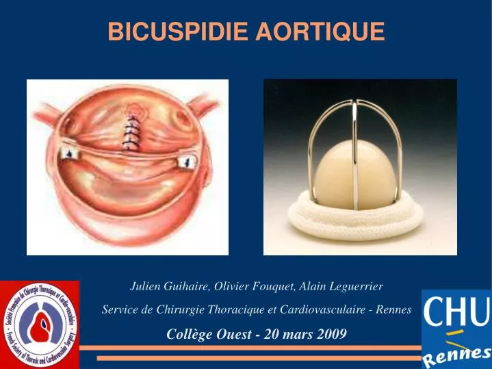PPT - BICUSPIDIE AORTIQUE PowerPoint Presentation, free download - ID ...