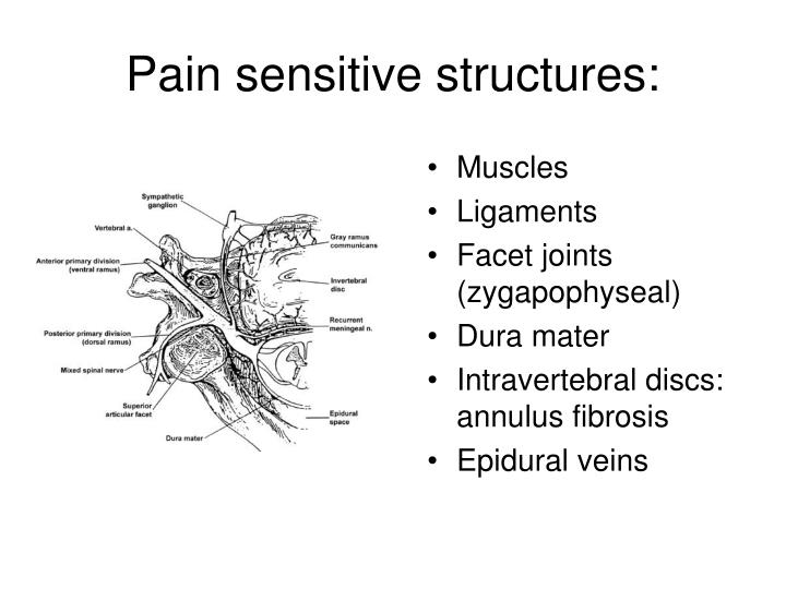 PPT - Cervical and low back pain and radiculopathy PowerPoint ...