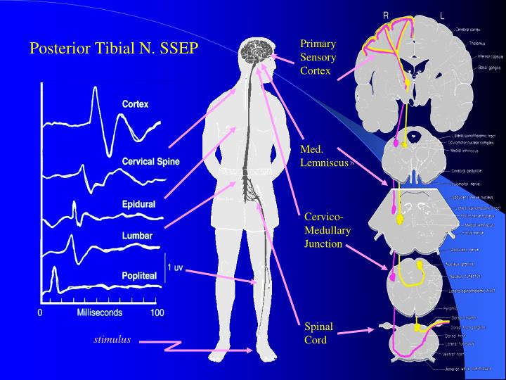 PPT - INTRAOPERATIVE NEUROPHYSIOLOGY AND NEUROMONITORING PowerPoint ...