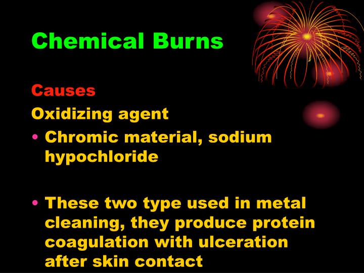 PPT - Burns and Scalds PowerPoint Presentation - ID:1253101