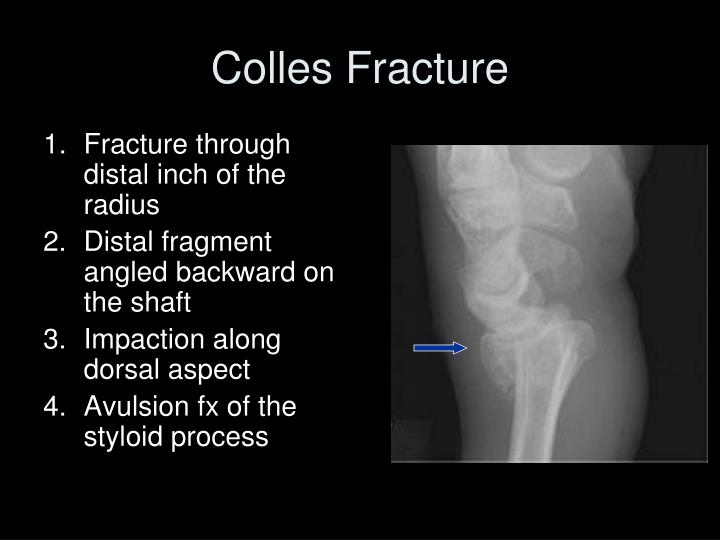 PPT - Trauma PowerPoint Presentation - ID:1256978