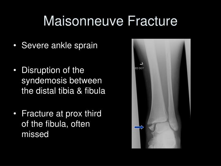 PPT - Trauma PowerPoint Presentation - ID:1256978