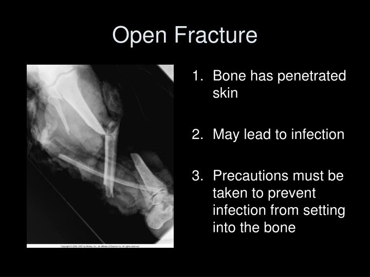 PPT - Trauma PowerPoint Presentation - ID:1256978