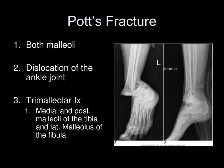 PPT - Trauma PowerPoint Presentation - ID:1256978