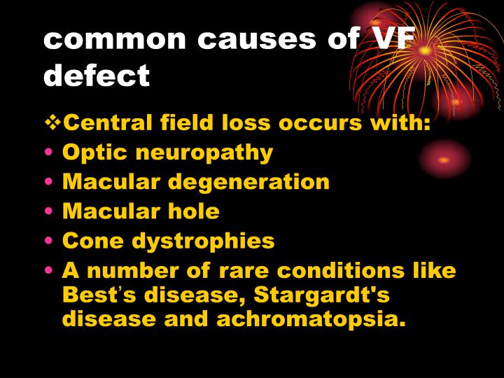 PPT - Visual field defects PowerPoint Presentation - ID:1257646