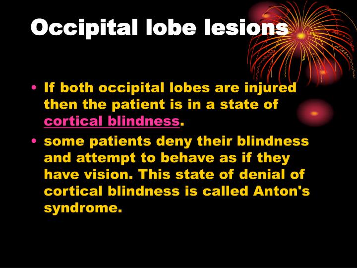 PPT - Visual field defects PowerPoint Presentation - ID:1257646
