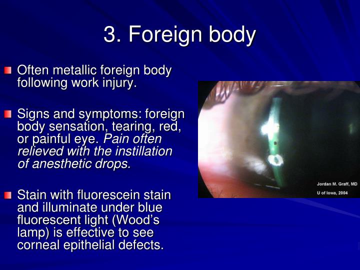 PPT - Ocular Emergencies PowerPoint Presentation - ID:1259257