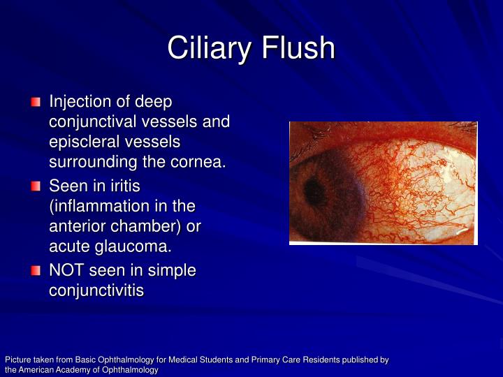 PPT - Ocular Emergencies PowerPoint Presentation - ID:1259257