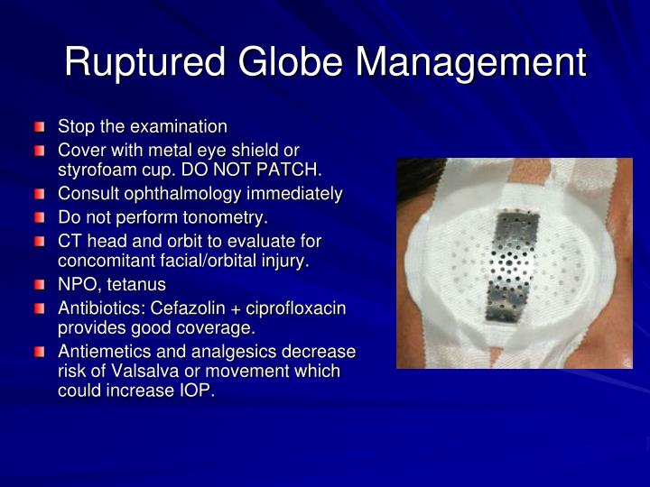 PPT - Ocular Emergencies PowerPoint Presentation - ID:1259257