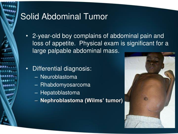PPT - Pediatric Abdominal Tumors: A Focus on Wilms’ Tumor PowerPoint ...
