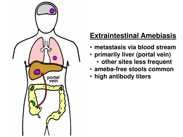 PPT - Intestinal Protozoa PowerPoint Presentation - ID:1261996
