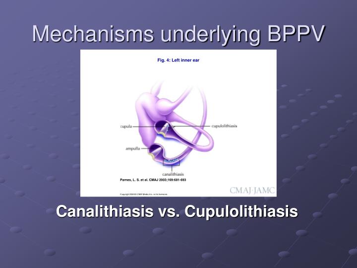 PPT - Benign Paroxysmal Positioning Vertigo (BPPV) PowerPoint ...