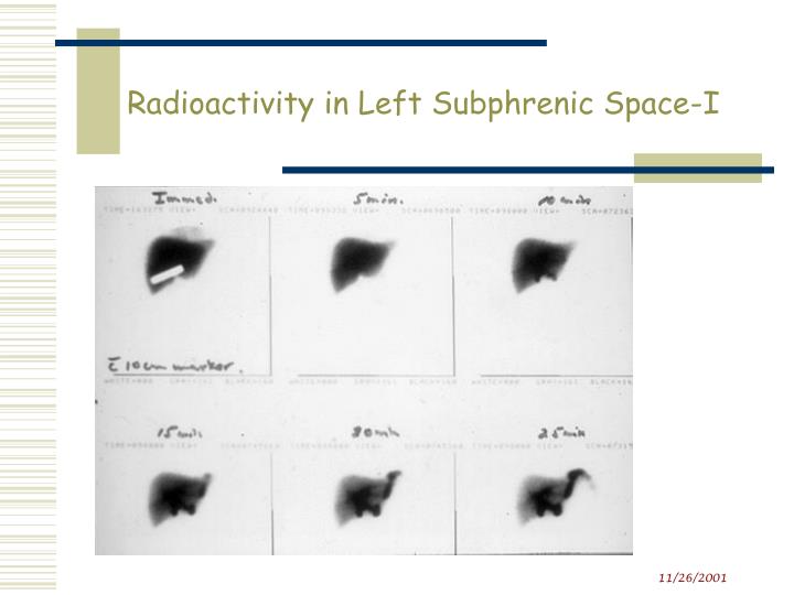 PPT - HEPATOBILIARY IMAGING PowerPoint Presentation - ID:1265912