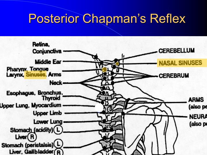 PPT - Osteopathic Treatment For Patients With Sinusitis PowerPoint ...