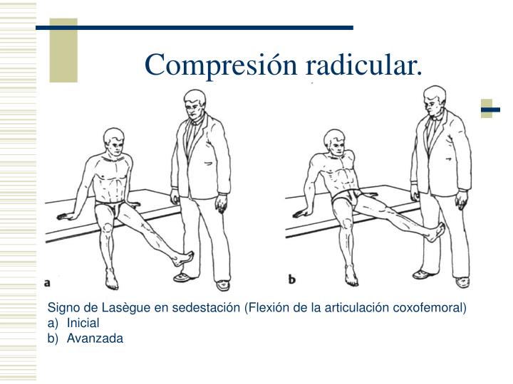 PPT - Exploracion de columna Lumbar PowerPoint Presentation - ID:1267902
