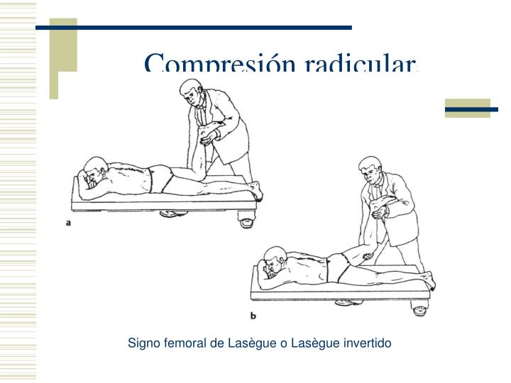 PPT - Exploracion de columna Lumbar PowerPoint Presentation - ID:1267902