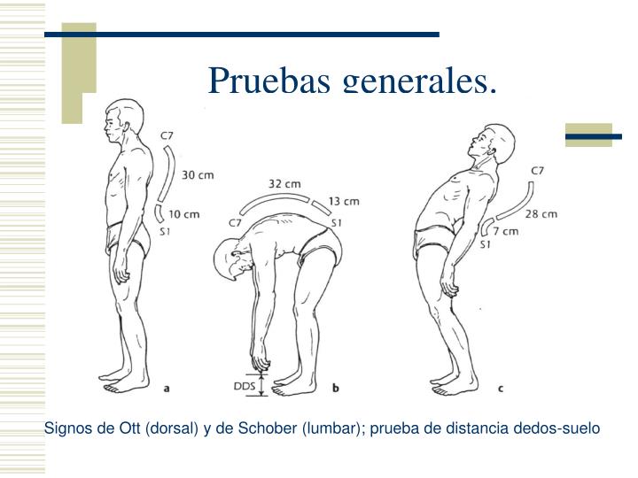 PPT - Exploracion de columna Lumbar PowerPoint Presentation - ID:1267902