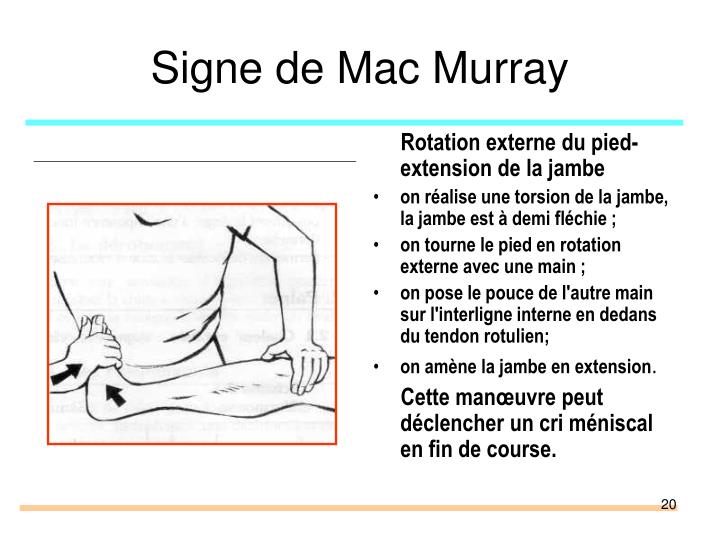 PPT - Pathologie péri-articulaire membre inférieur PowerPoint ...