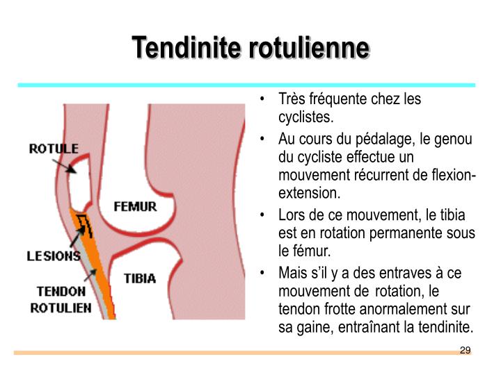 PPT - Pathologie péri-articulaire membre inférieur PowerPoint ...