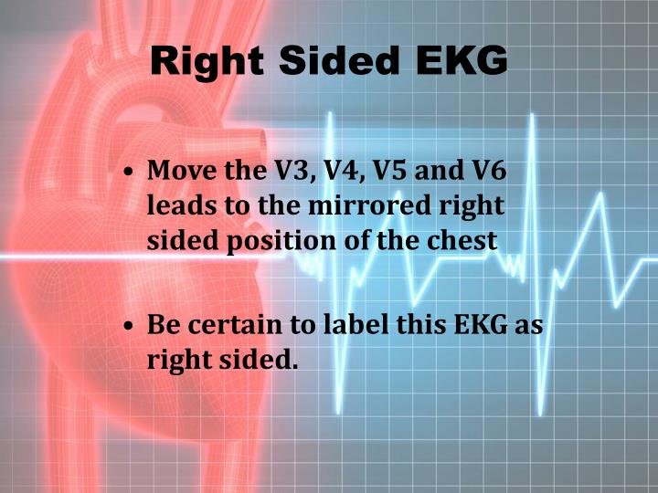 PPT - Acute Coronary Syndrome PowerPoint Presentation - ID:1269652