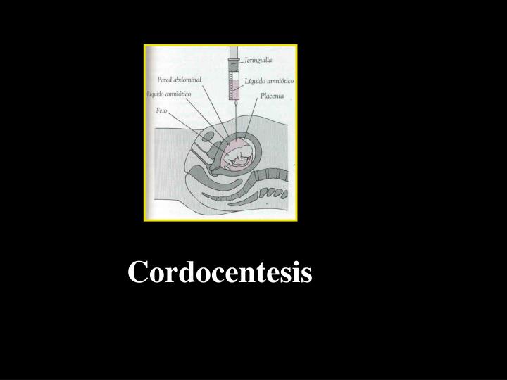 PPT - ISOINMUNIZACION MATERNO-FETAL PowerPoint Presentation - ID:1270019