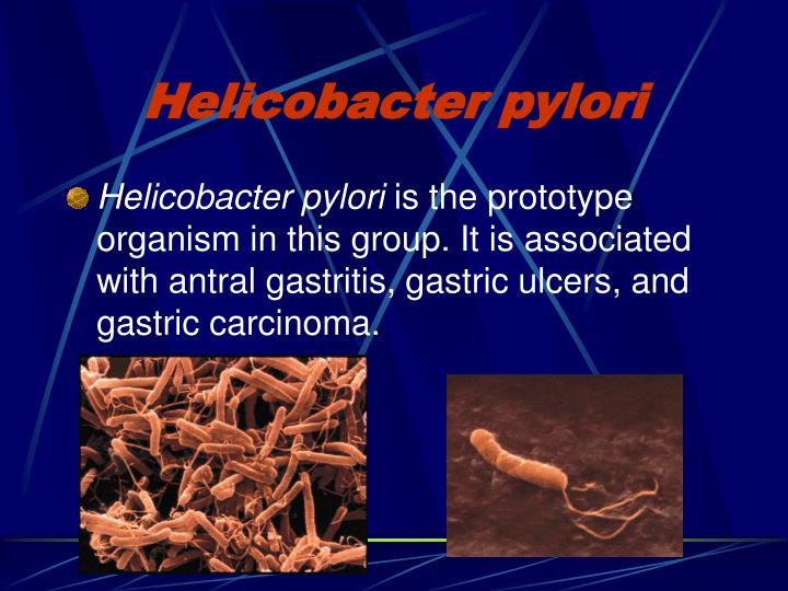 PPT - Campylobacter PowerPoint Presentation - ID:1270034