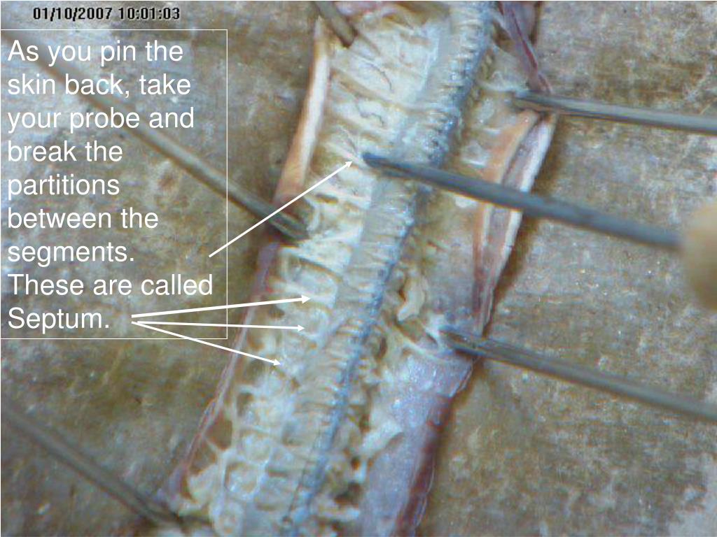 Lumbricus Terrestris Dissection