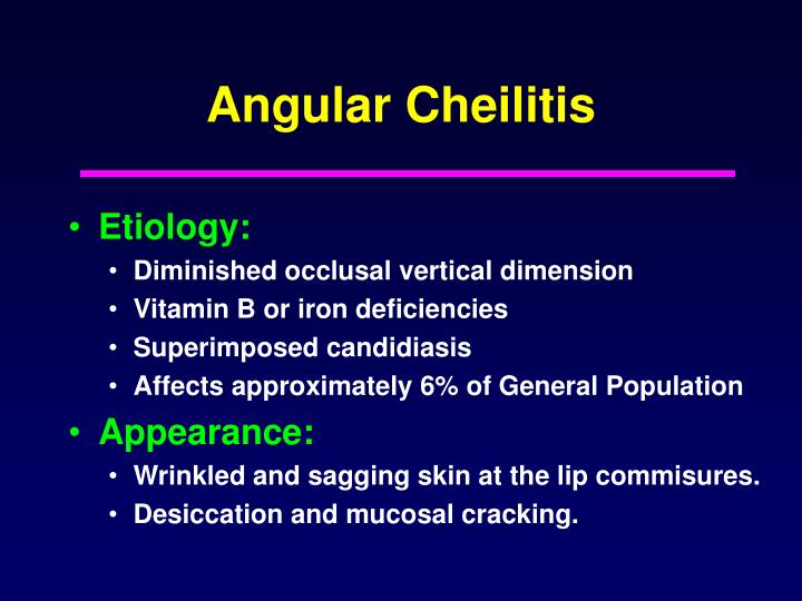 PPT - Recurrent Aphthous Ulcer PowerPoint Presentation - ID:1272543