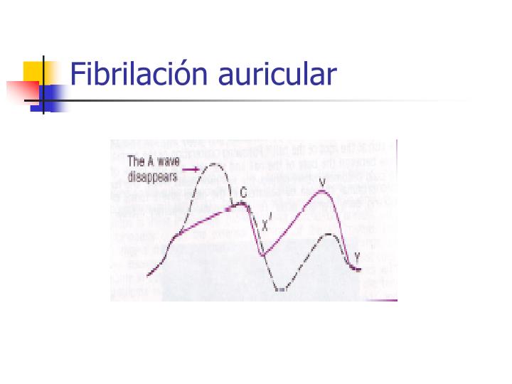 PPT - Pulsos arteriales y venosos PowerPoint Presentation - ID:1272639