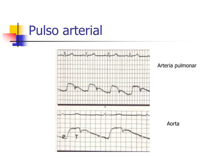 PPT - Pulsos arteriales y venosos PowerPoint Presentation - ID:1272639