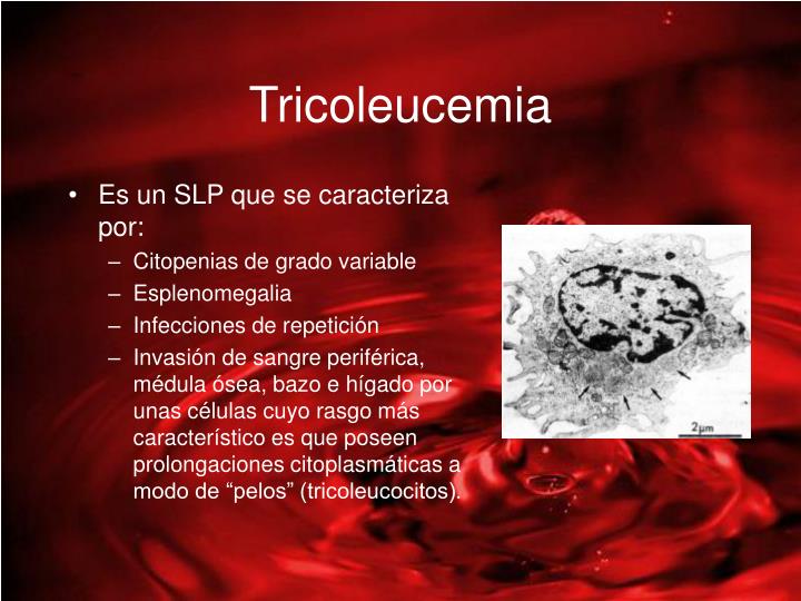 PPT - ANEMIA PowerPoint Presentation - ID:1272788