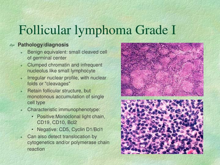 PPT - Pathology of Lymph Nodes PowerPoint Presentation - ID:1273193