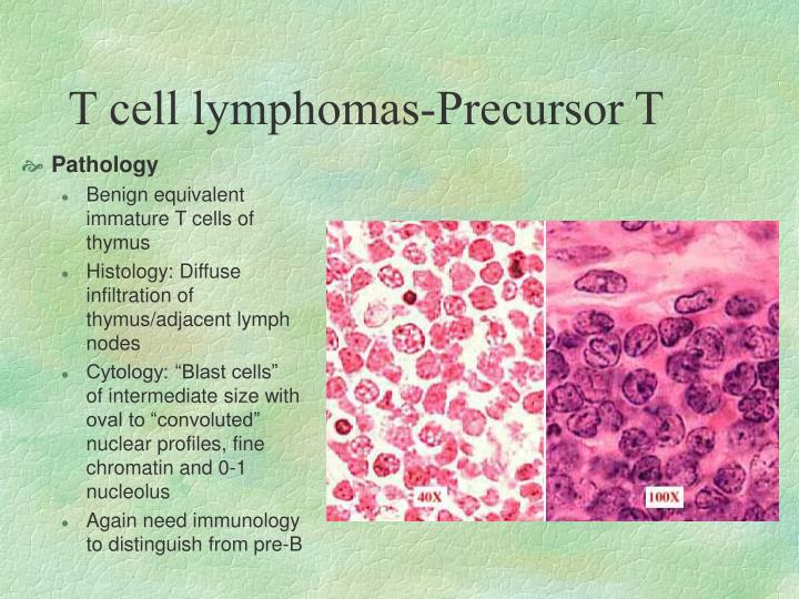 PPT - Pathology of Lymph Nodes PowerPoint Presentation - ID:1273193
