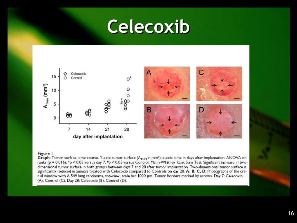 PPT - Anti-Angiogenic Cancer Therapies PowerPoint Presentation, free ...