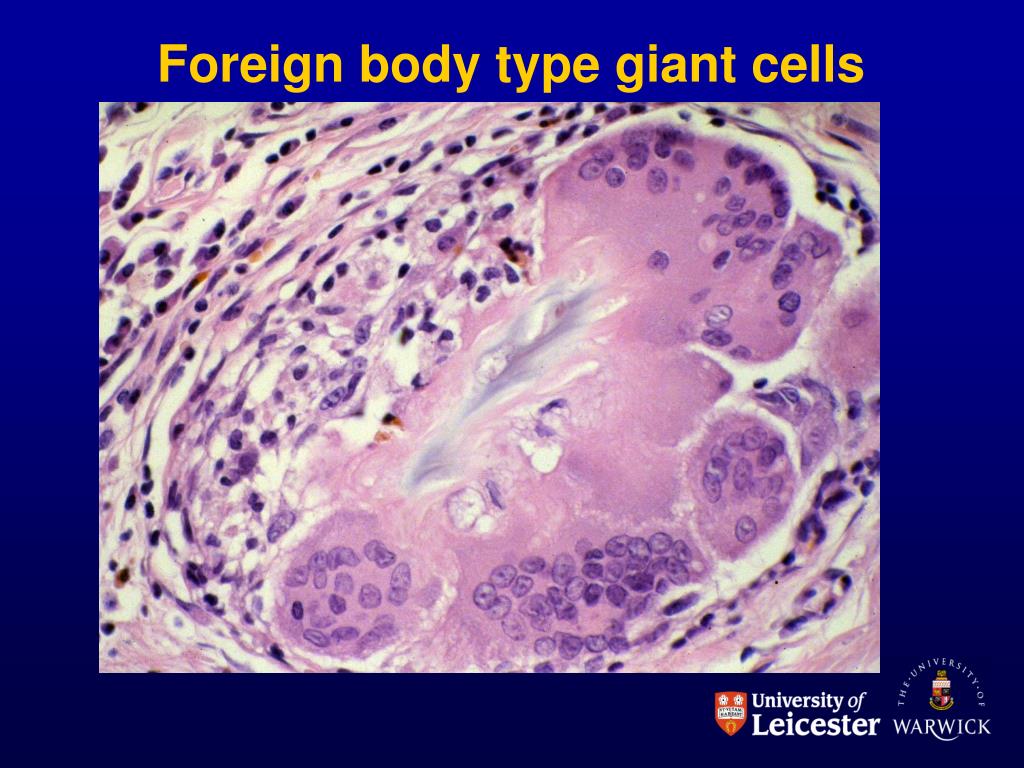 Ppt Leicester Warwick Medical School Powerpoint Presentation Free