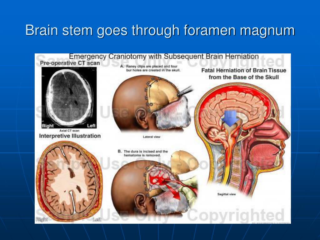 PPT - Adedayo Ashana, MS1 Univ. of Pennsylvania, School of Medicine ...