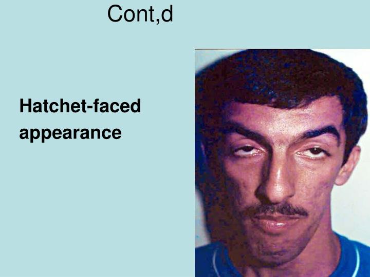 PPT - Approach to the patient with Myopathy PowerPoint Presentation ...