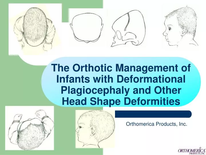 PPT - The Orthotic Management of Infants with Deformational ...